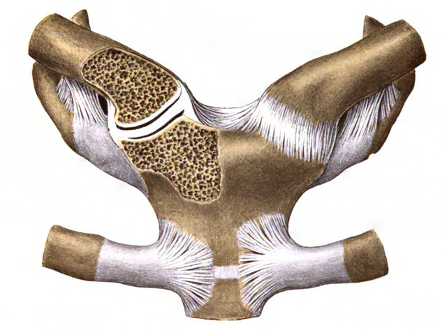 Causes of Venous Thoracic Outlet Syndrome • Thoracic Outlet Syndrome ...